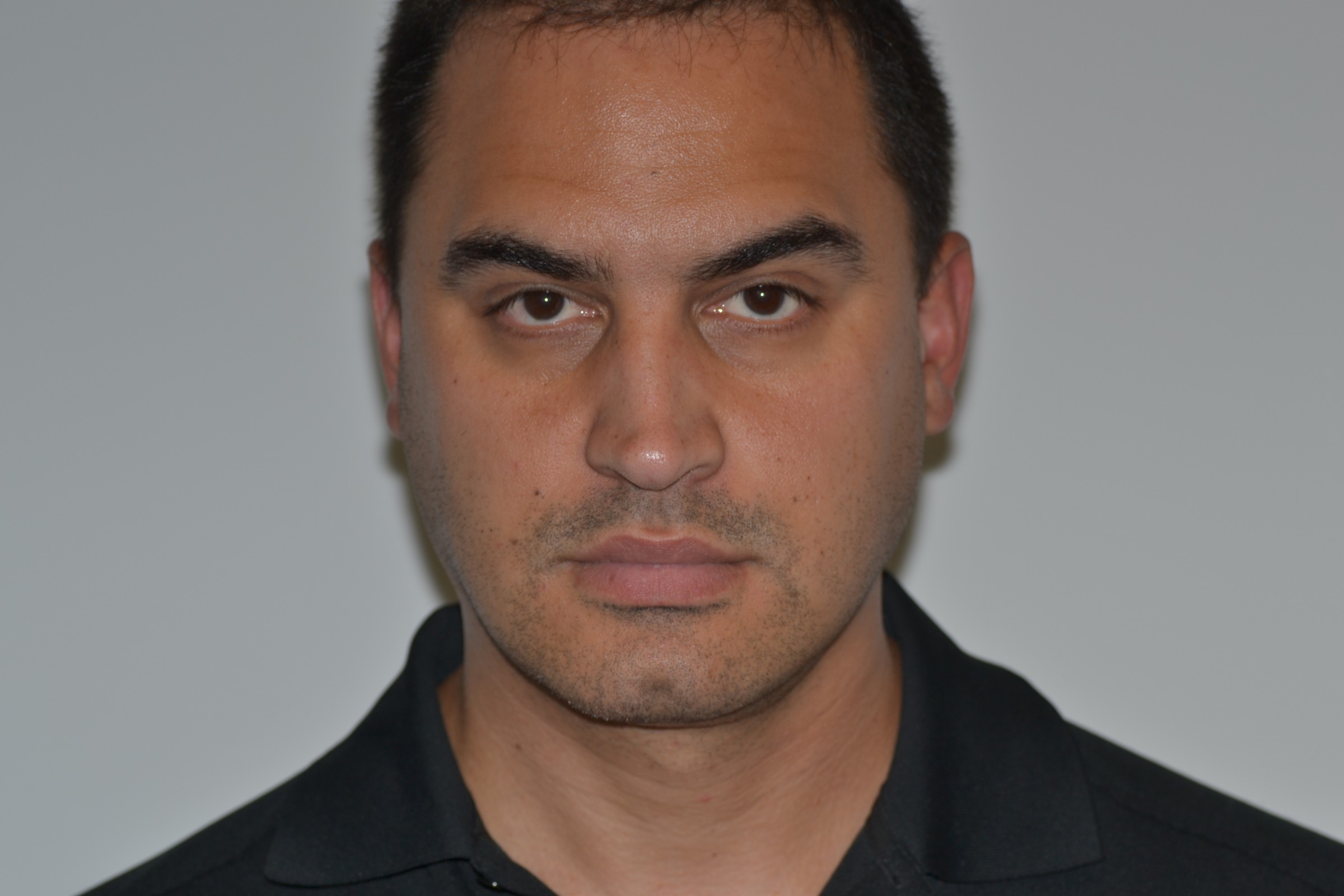 Jaw Surgery Before & After Photos Park Ridge IL | Smile Gallery